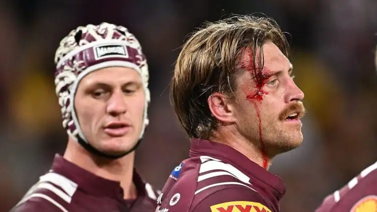 Eye gouge allegation and scandal rocks Women’s State of Origin opener